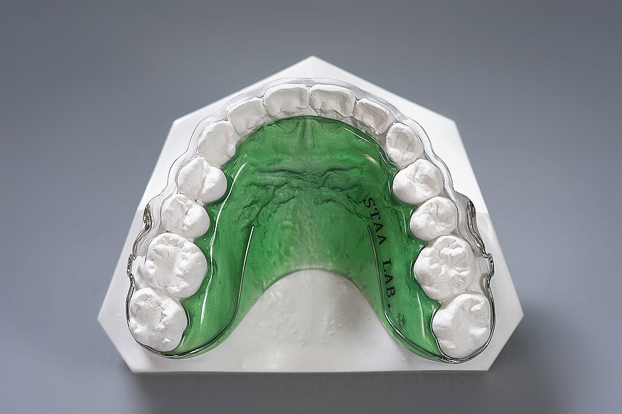 MOD Retainer – C clasp solder – STAALAB