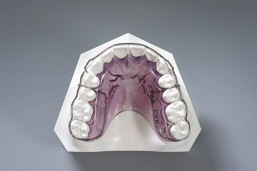 Wraparound Retainer – STAALAB