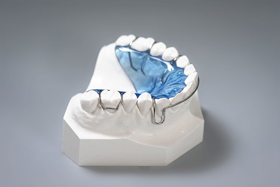 Hawley Retainer – Upper – STAALAB