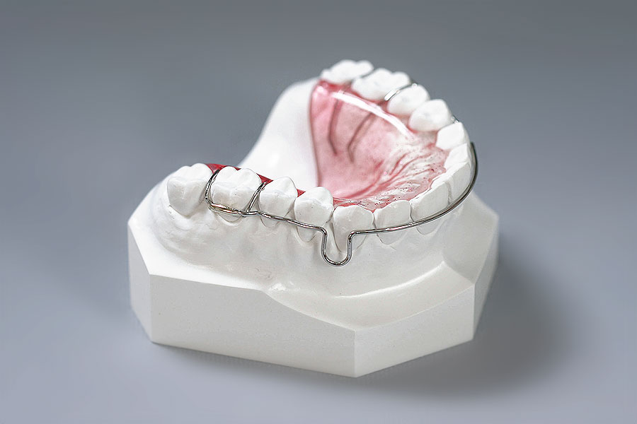 MOD Retainer – Adam’s clasp solder – STAALAB