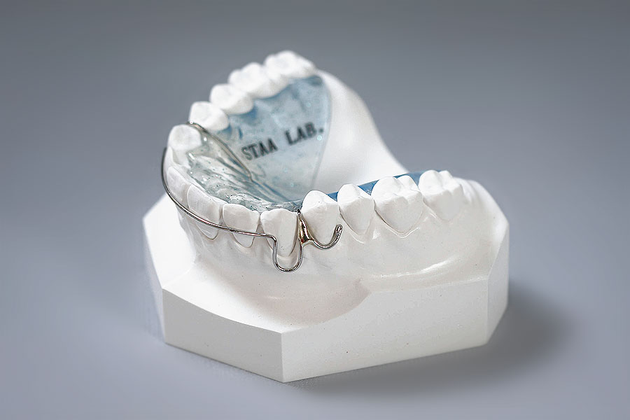 MOD Retainer – C clasp solder – STAALAB