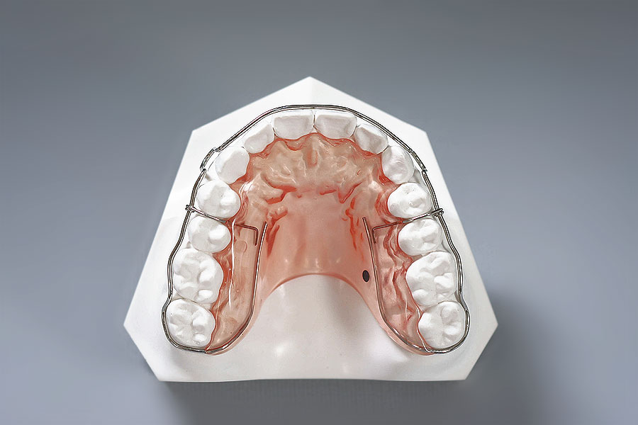 Wraparound Retainer – STAALAB