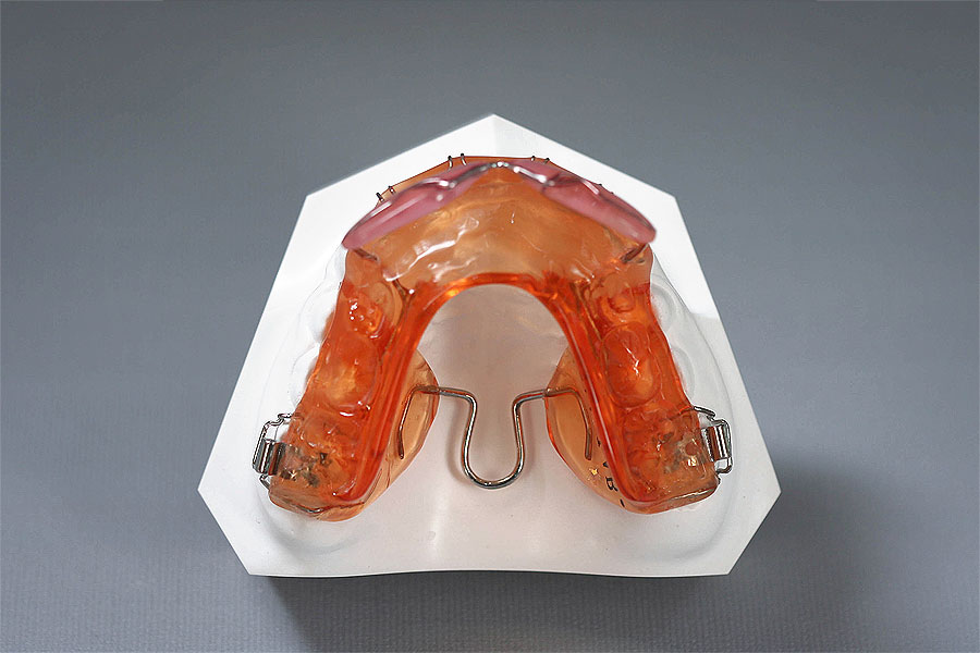 Teuscher Activator – STAALAB