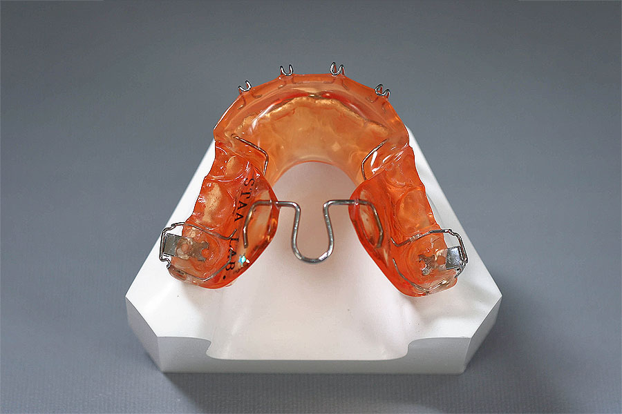 Teuscher Activator – STAALAB