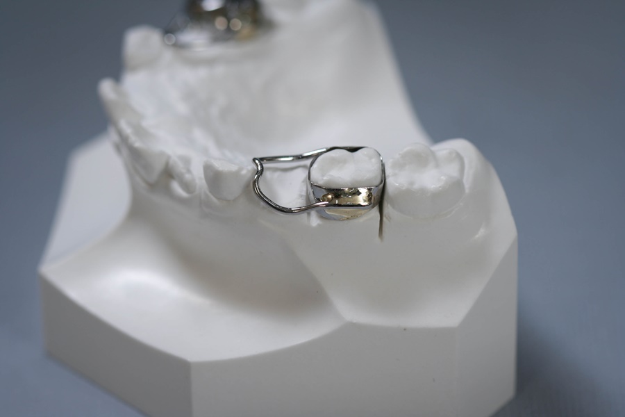 Band(Cr)& Loop – STAALAB