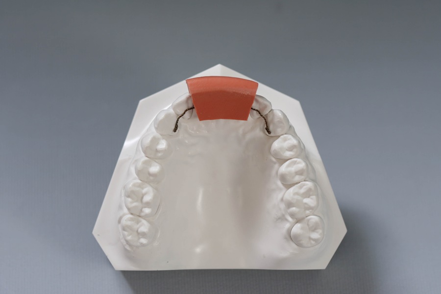 Fixed Retainer(3×3)&Putty Tray – STAALAB