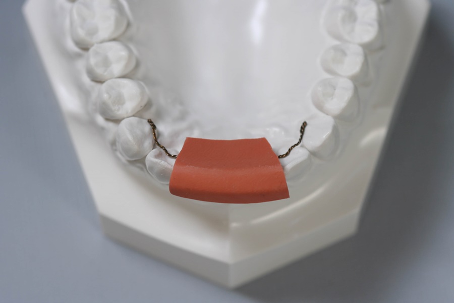 Fixed Retainer(3×3)&Putty Tray – STAALAB