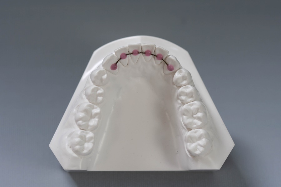 Fixed Retainer(3×3)&Putty Tray – STAALAB