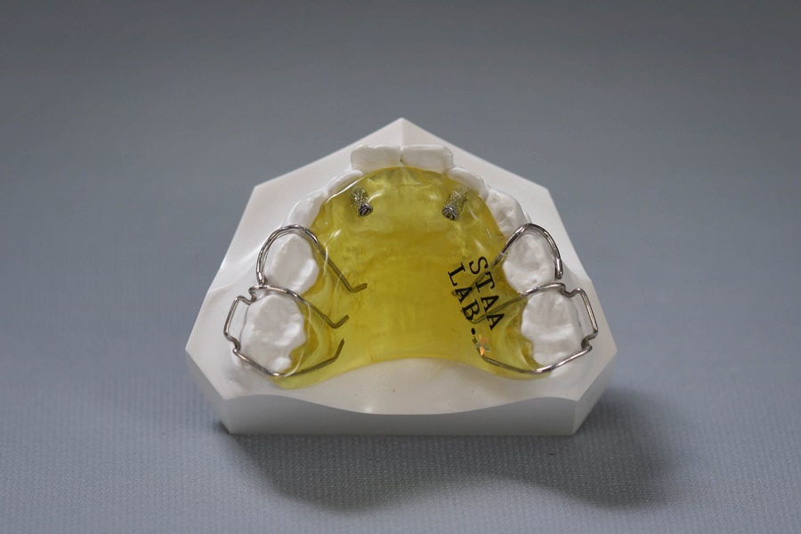 13)Hawley With Mini Screw3 – STAALAB