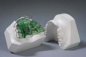 Upper Schwarz with Inverted Labial Bow – STAALAB