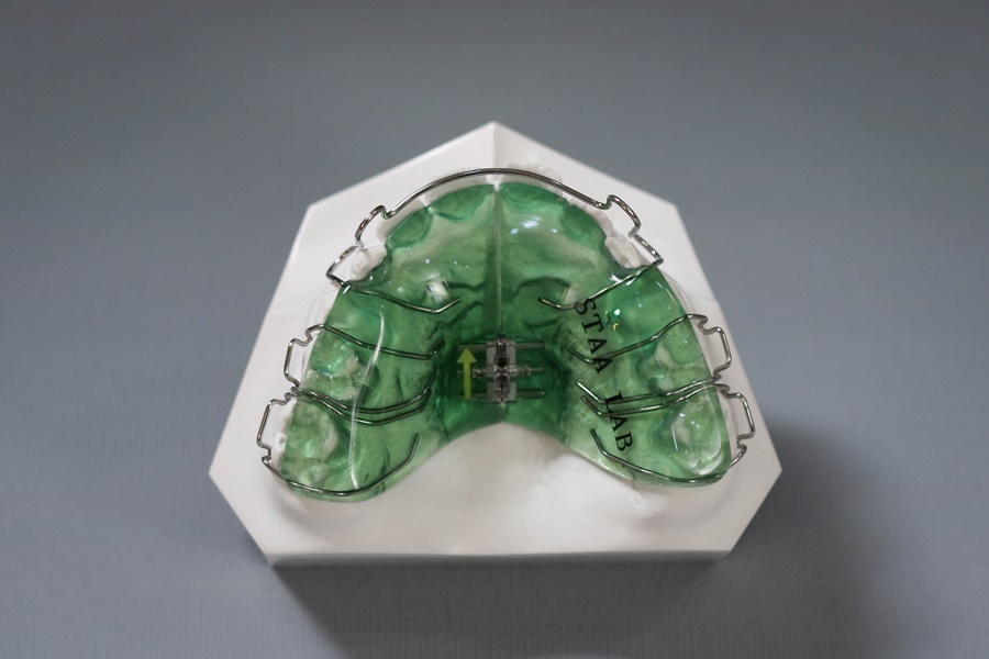 Upper Schwarz with Inverted Labial Bow – STAALAB