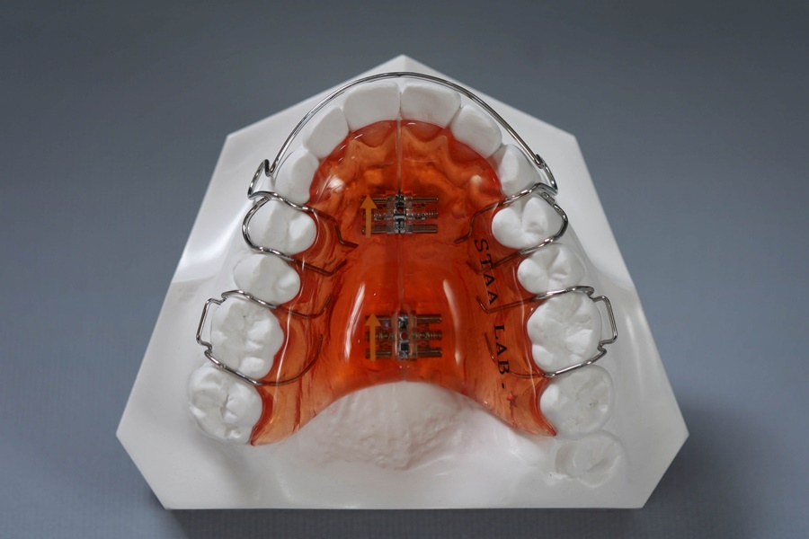 Active plate App | STAALAB