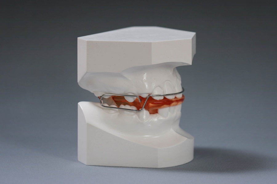 Baiter’s bionator – STAALAB