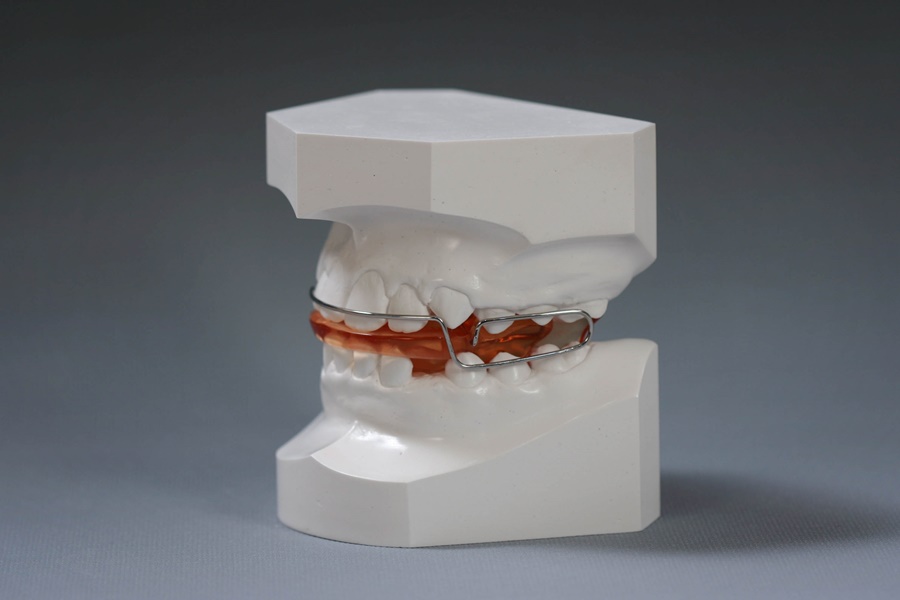 Baiter’s bionator – STAALAB