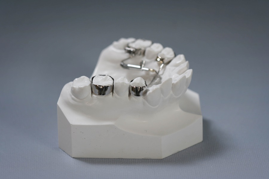 7)Distal Jet (Bilateral)2 – STAALAB