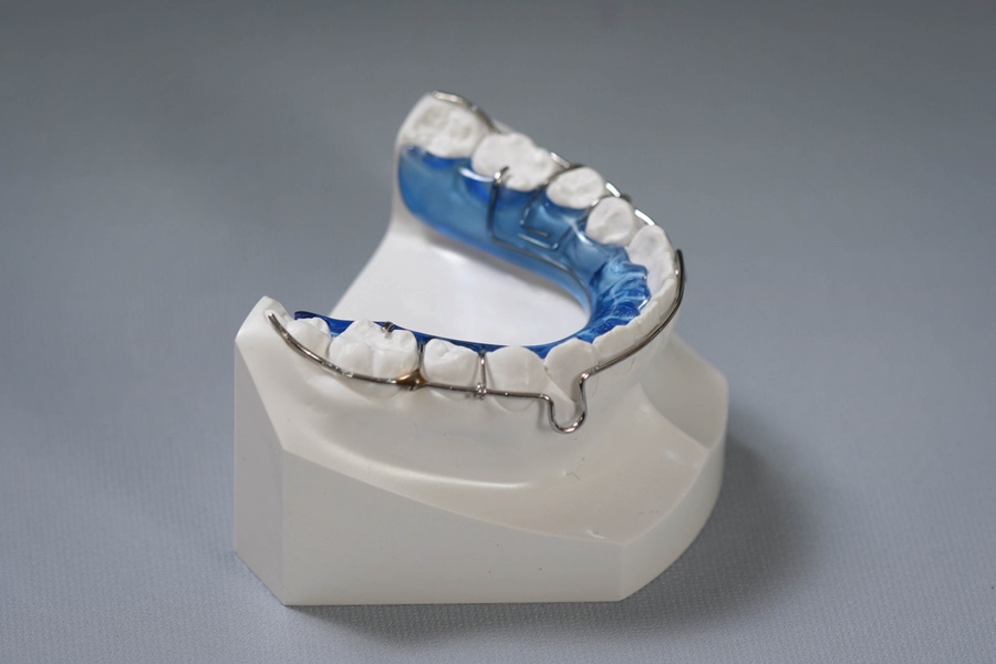 MOD Retainer – Cross wire solder – STAALAB