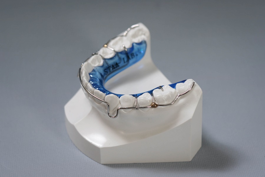 MOD Retainer – Cross wire solder – STAALAB