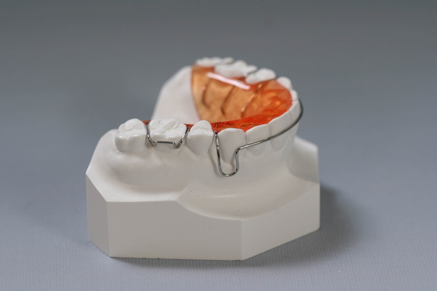 Hawley with Anterior bite plate – STAALAB