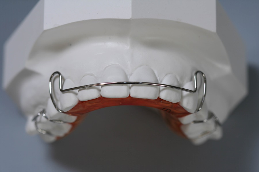 Hawley with Anterior bite plate – STAALAB